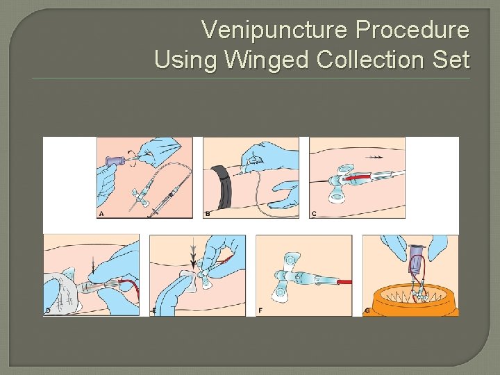 Lesson 1 12 Routine Venipuncture Routine Venipuncture Phlebotomy
