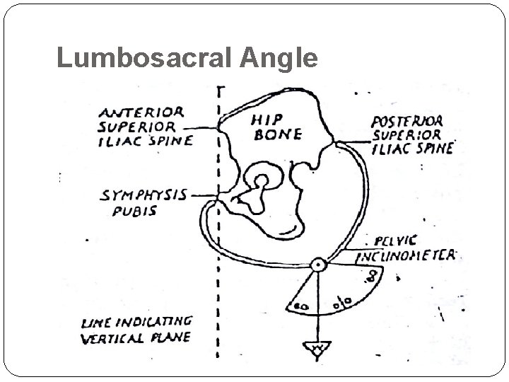 Pelvic tilt Dr Atif Malik objectives What is