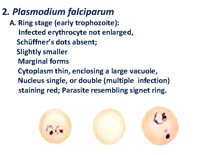 Protozoa Lab Plasmodium spp Part II Life Cycle