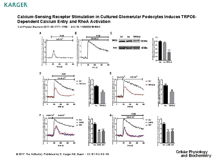 CalciumSensing Receptor Stimulation in Cultured Glomerular Podocytes ...
