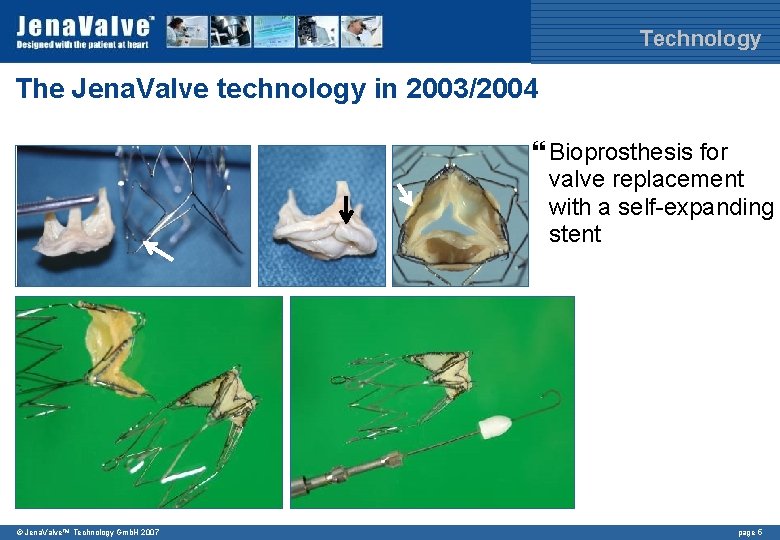 Jena Valves Aortic Clip Concept for Aortic Valve