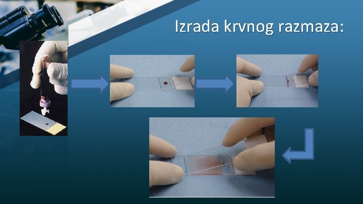 DIFERENCIJALNA KRVNA SLIKA Nediljka Petrovski bacc med lab