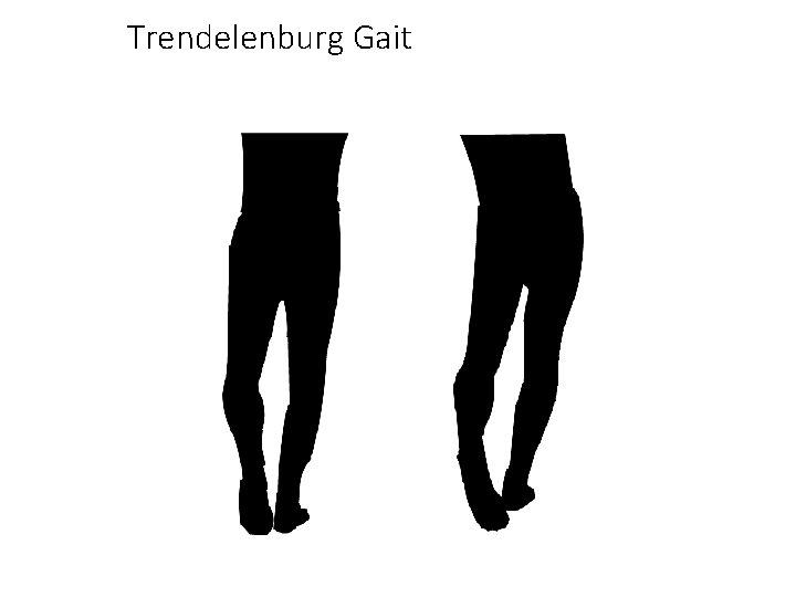 Module 2 Lower LimbGluteal Region and Posterior Compartment