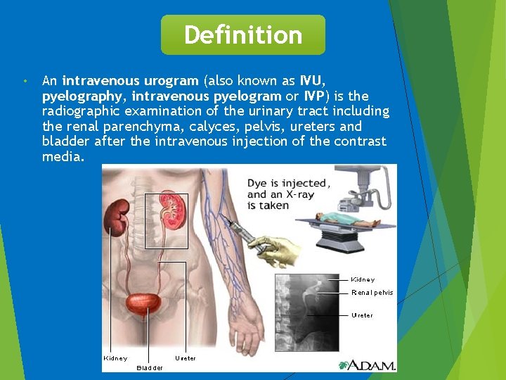 IMAGING TECHNIQUES IN URINARY SYSTEM HISTORY Dates back