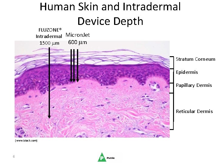 Evaluation of ZOSTAVAX Via the Intradermal Route Using