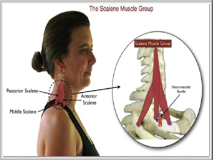 Muscles of Head Neck By Dr Pardeep Kumar