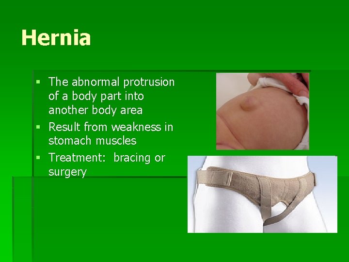 The Muscular System Muscular System The body has