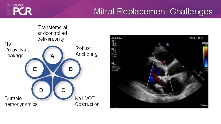 Cardiovalve Device Attributes Implant Procedure and Early Results