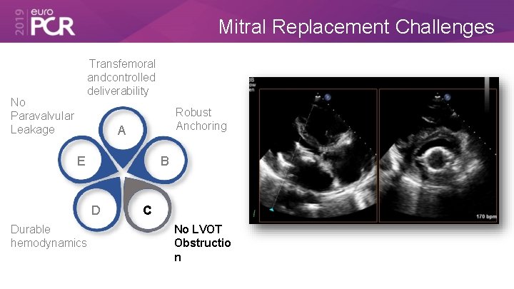 Cardiovalve Device Attributes Implant Procedure and Early Results