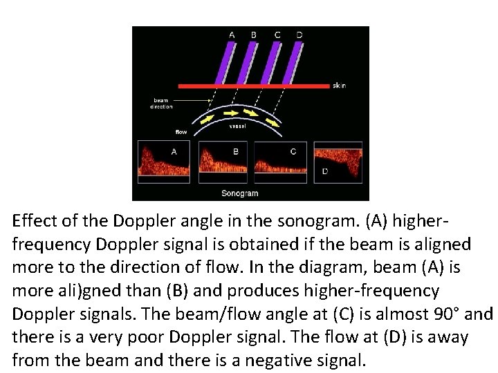 Imaging of Blood Flow with US Ultrasound images