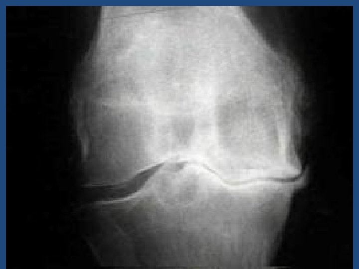Problems in Musculoskeletal system Dr Fadi Hadidi MD