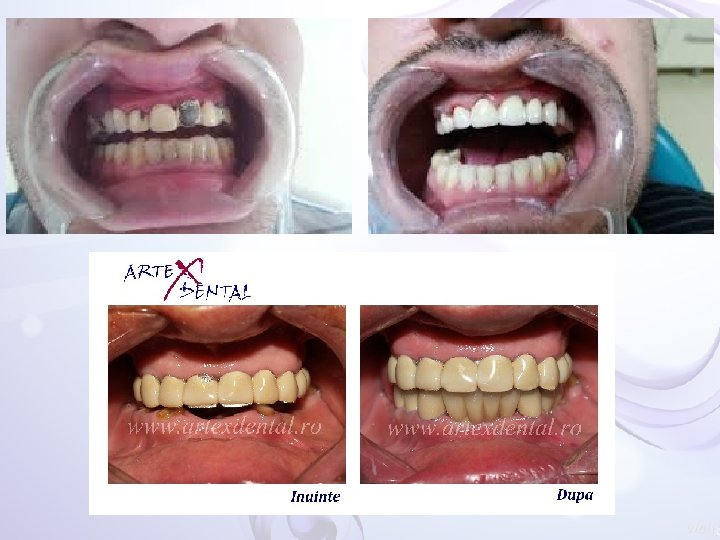 CORPUL DE PUNTE CURSUL VI TEHNOLOGIA CONFECTIONARII PRITEZELOR