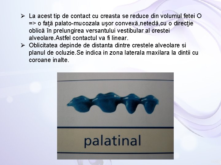 CORPUL DE PUNTE CURSUL VI TEHNOLOGIA CONFECTIONARII PRITEZELOR