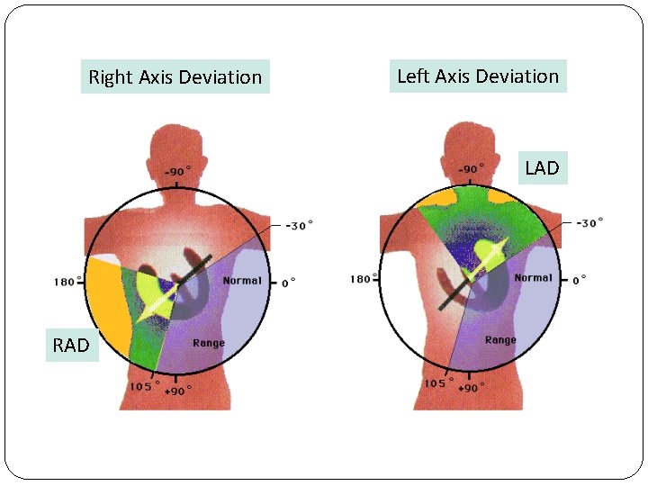 Elektrokardiografi EKG Normal Conduction System SA node Sumber