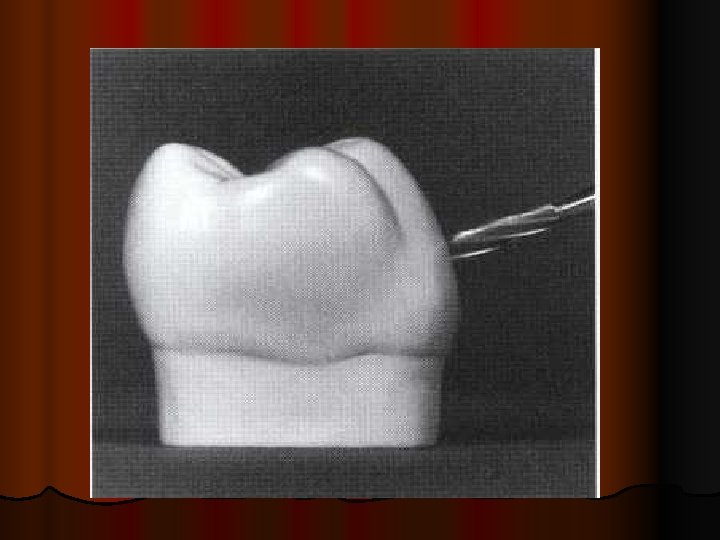 Classes I cavity preparation and Restorations The outline