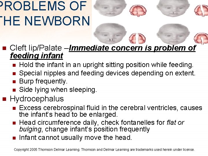 CHAPTER 54 NEWBORN CARE Part 3 Copyright 2005