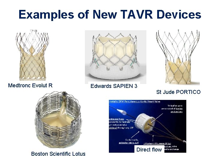 How PVL Post TAVR Impact Outcome And How