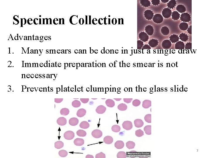 Examination of Peripheral Blood Smear Dr S Homathy