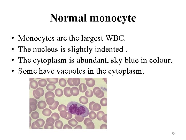 Examination of Peripheral Blood Smear Dr S Homathy
