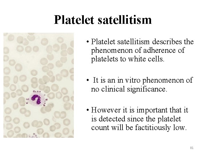 Examination of Peripheral Blood Smear Dr S Homathy