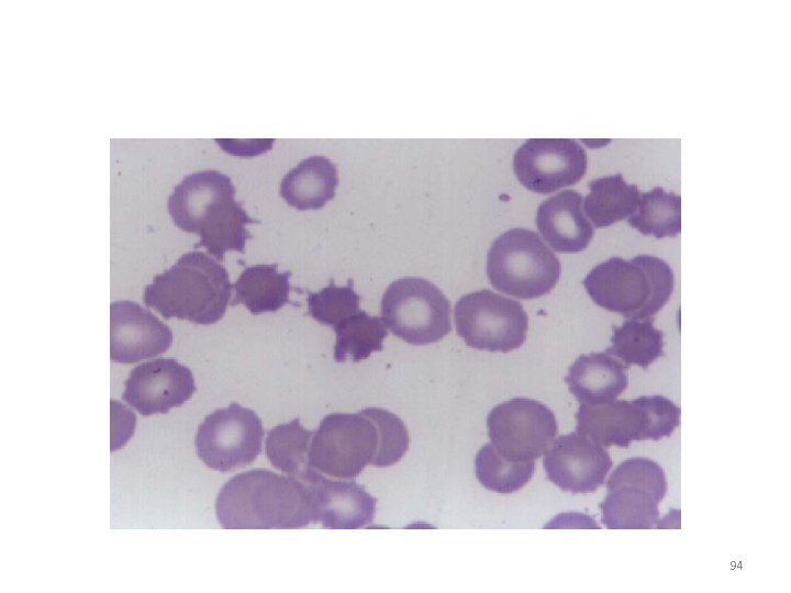 Examination of Peripheral Blood Smear Dr S Homathy
