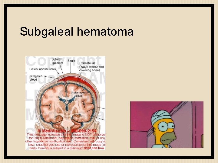 HEAD INJURY Done By Yara khaled yaseen Definition