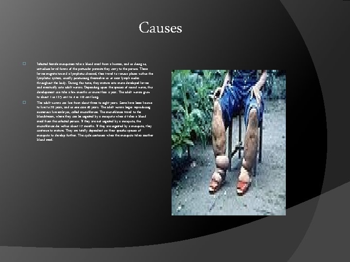 Elephantiasis BY CHRISTIAN HESS Elephantitis or Elephantiasis Elephantitis