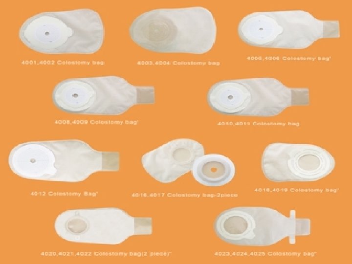 STOMA CARE DEFINITION A stoma is an opening