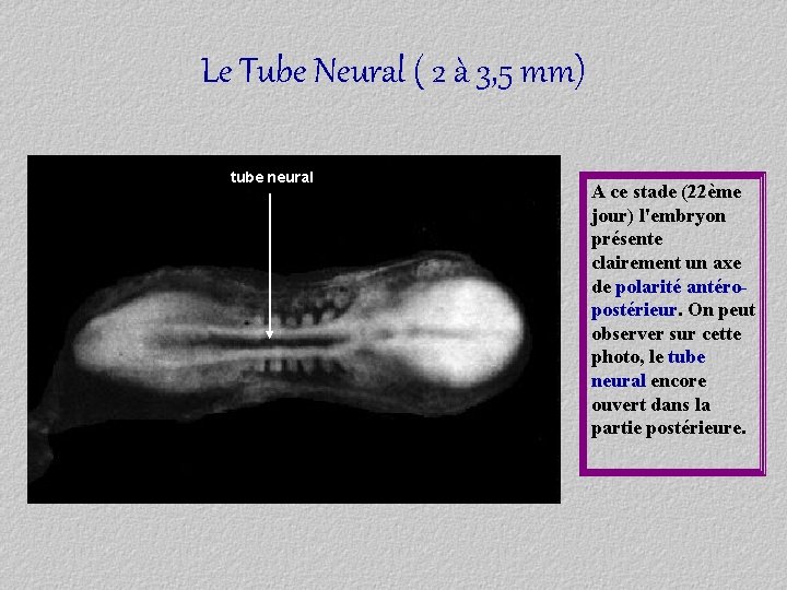 Les Etapes du Dveloppement Embryonnaire chez lHomme Et