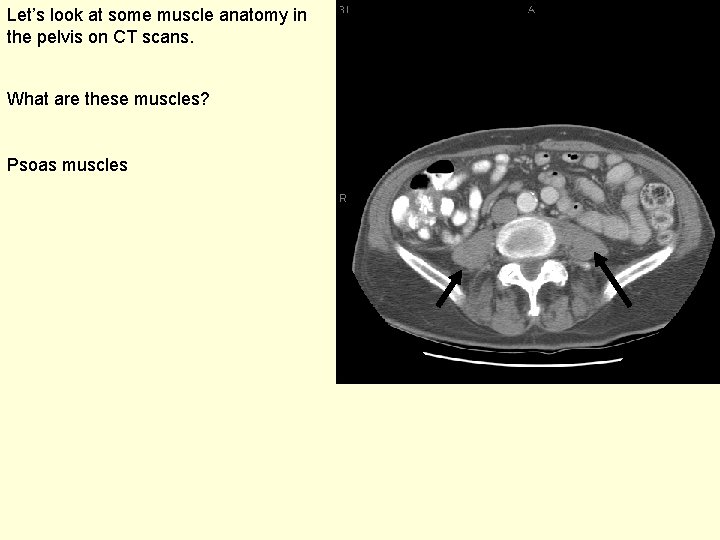 Lets look at some muscle anatomy in the