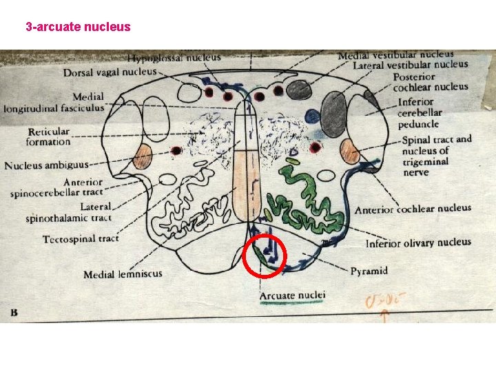 Brain stem l 1 Medulla oblongata l 2