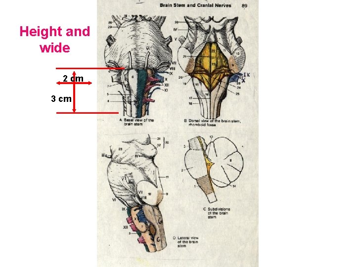 Brain stem l 1 Medulla oblongata l 2
