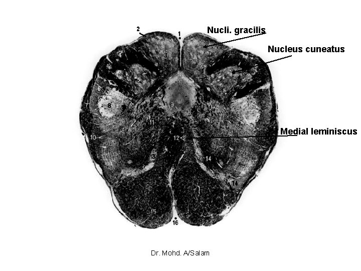 Brain stem Dr Mohamed Abdel Salam Nurein Anatomy