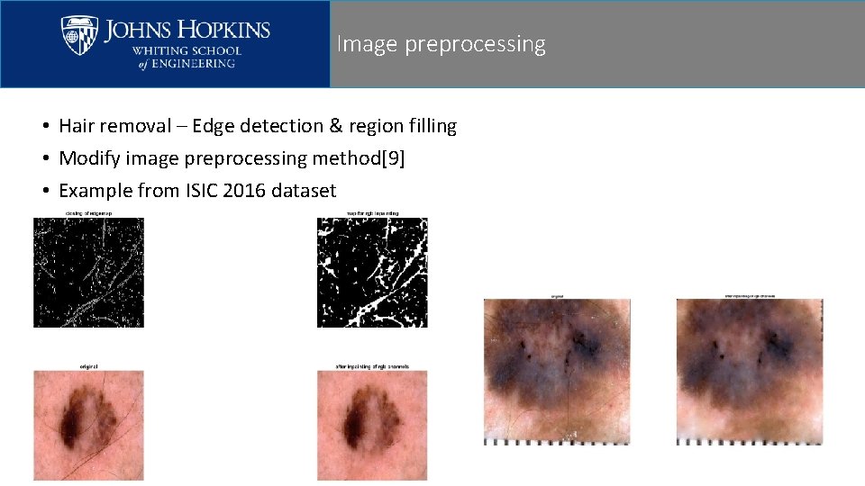 Multispectral Image Analysis for Skin Condition Diagnosis Alison