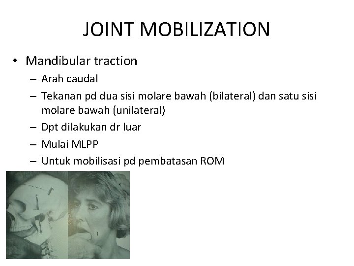 MANUALTERAPI PADA TEMPOROMANDIBULAR JOINT INTERVENSI Temu 3 Oleh
