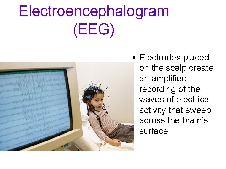Ways to study the Brain Accidents damage to