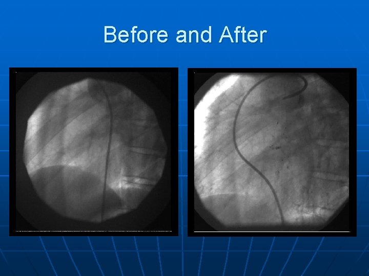 Thomas Hoy Department of Biomedical Engineering BME 273
