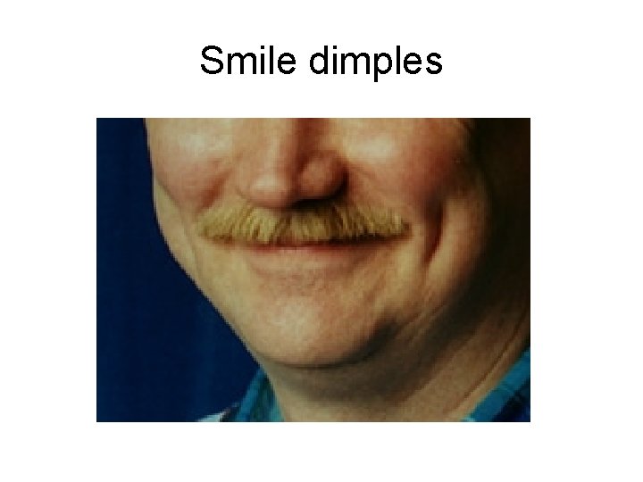 Traits Ear lobes Hair on fingers Widows peak