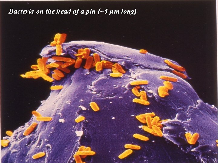 Microbes The Good The Bad and the Globally