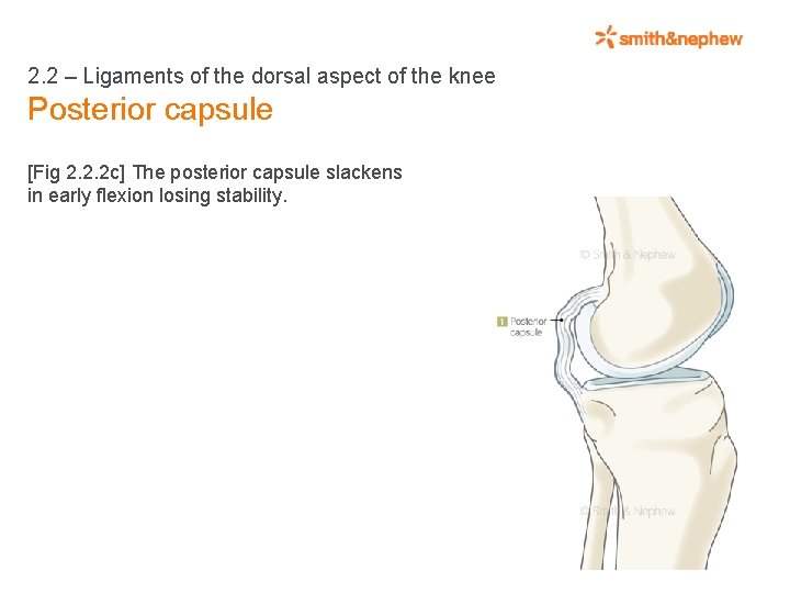 Ligament Balancing in Total Knee Arthroplasty Section 2