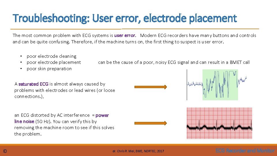 ECG Recorder and Monitor q principles of operation