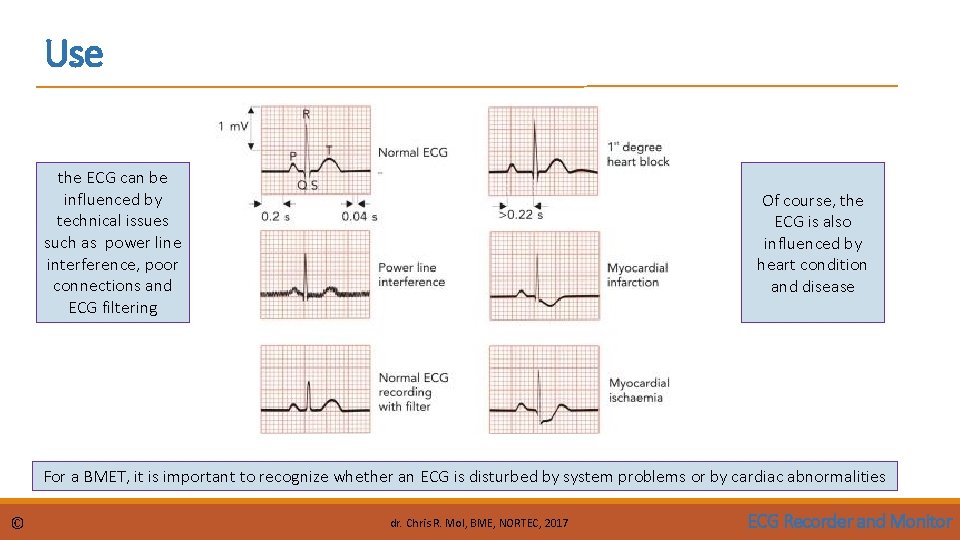 ECG Recorder and Monitor q principles of operation