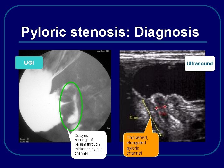 COMMON SURGICAL PROBLEMS IN CHILDREN Dr P M