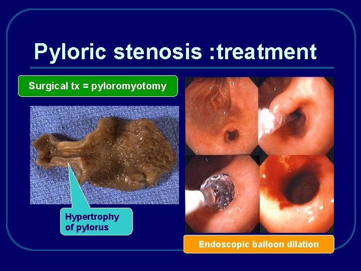 COMMON SURGICAL PROBLEMS IN CHILDREN Dr P M