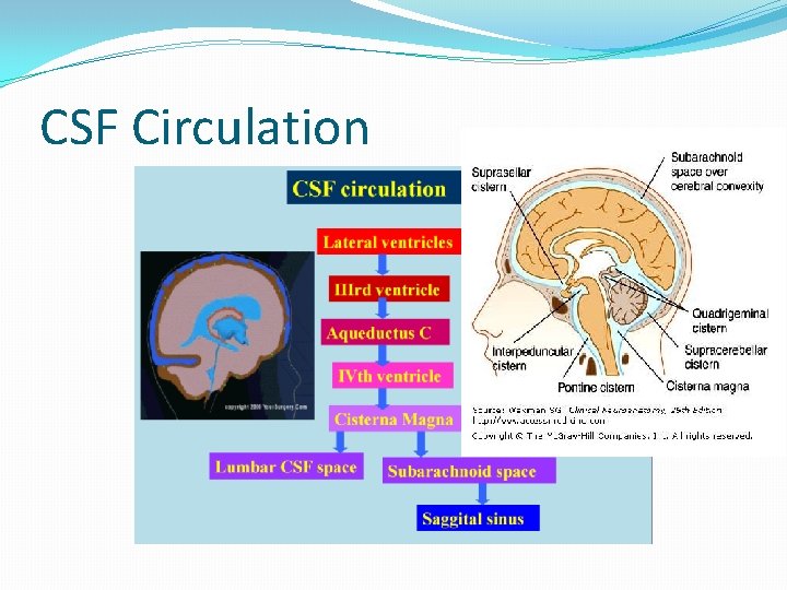 Hydrocephalus Volume of brain 1400 ml Volume of
