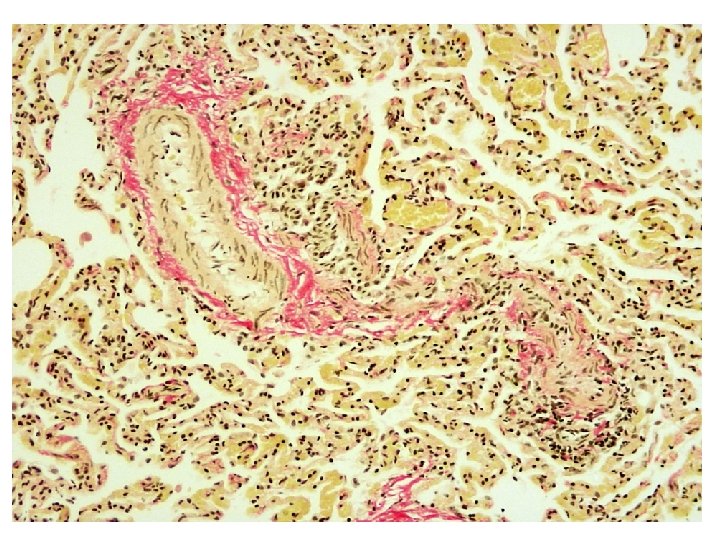Special stains in Histopathology Special stains i Van