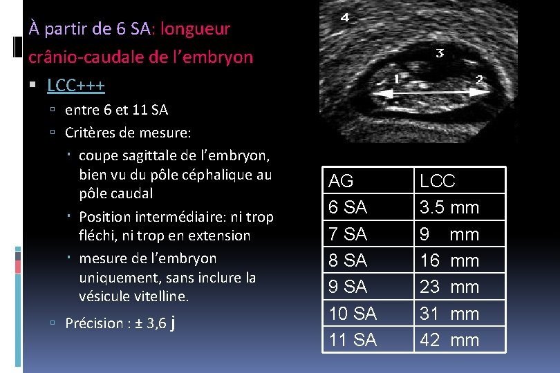 IMAGERIE DE LA GROSSESSE NORMALE Imagerie de la