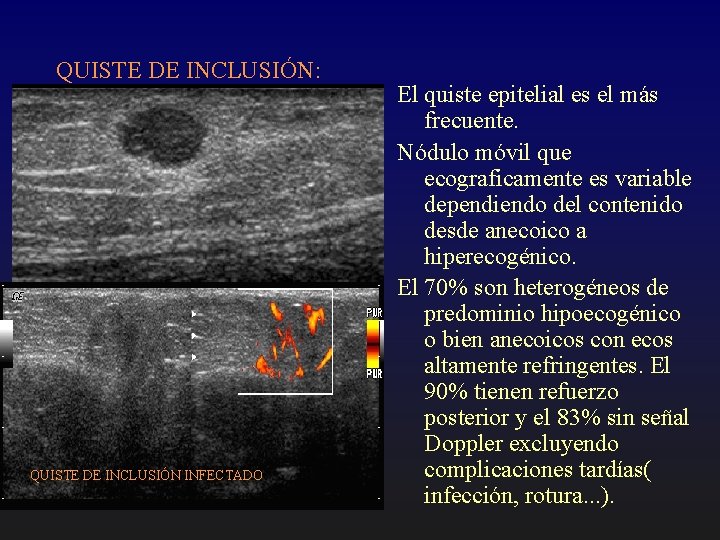 LESIONES TUMORALES DEL TEJIDO CELULAR SUBCUTNEO Caractersticamente se