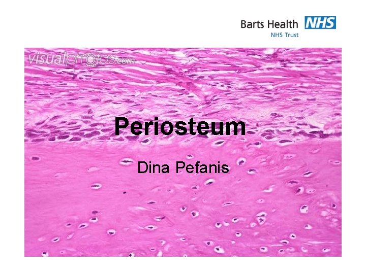 Periosteum Dina Pefanis Definition A connective tissue layer
