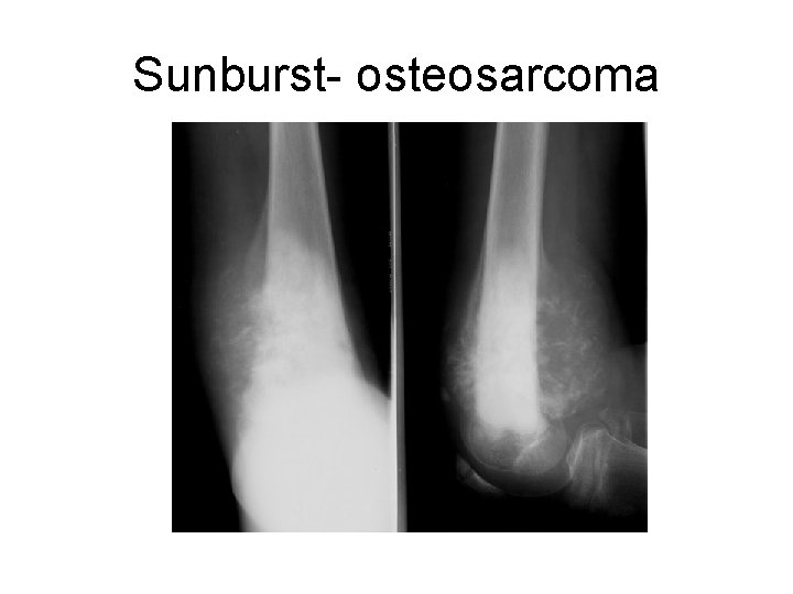 Periosteum Dina Pefanis Definition A connective tissue layer